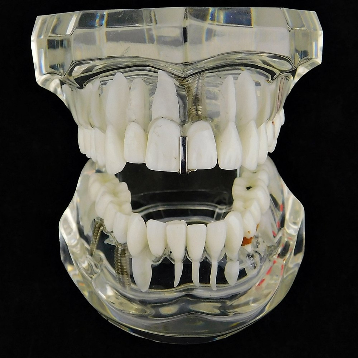 Gap Grillz Silver Tone Single Plain Tooth Top or Bottom Teeth Single Hip Hop Grills