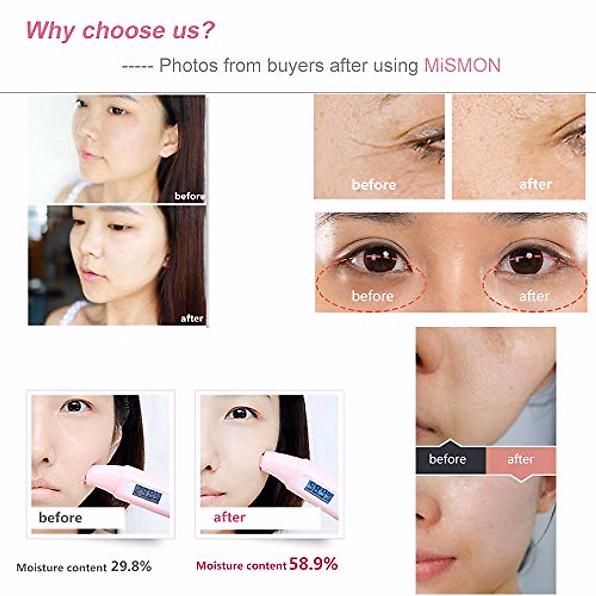 MiSMON High Frequency Facial Machine LED Light Theraphy Skin Tightening Device for Face, 5 in 1 Multifunctional Facial Massager for Wrinkle and Acne Removal