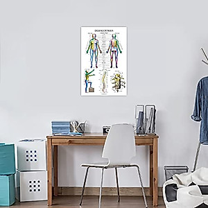 Palace Learning Dermatomes & Nervous System Anatomical Chart - Dermatomes Anatomy Poster