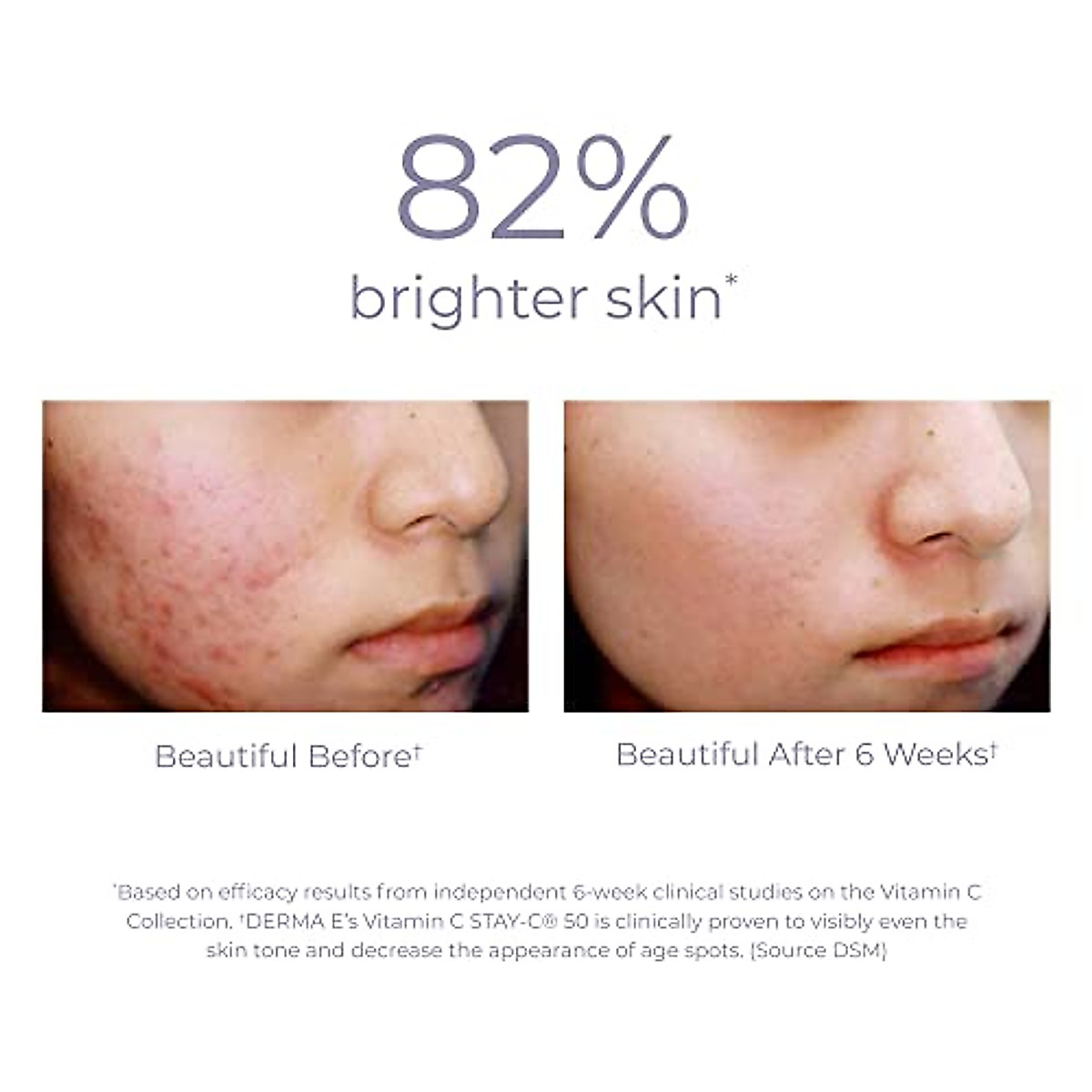 DERMA-E Vitamin C Cleanser - Daily Brightening Cleanser – Hydrating Face Wash to Even Out Skin Tone – Moisturizing Face Cleanser for a Radiant Glow, 6 fl oz