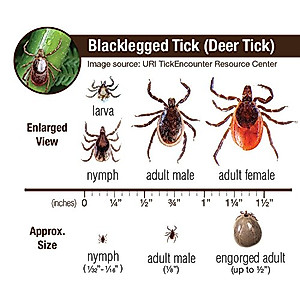 eTradewinds Tick Remover Tool Kit Tweezers & Tick Identifier Card - Hygienic All Stainless Steel Tick Removal Instrument Ideal for Human, Dog, Cat & General Pet Tick Puller w/Leather Case