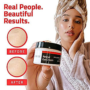 Yeouth Retinol Eye Cream with Hyaluronic Acid, Under Eye Cream for Dark Circles and Puffiness, Under Eye Bags, Hydrating Under Eye Cream, Eye Skin Care