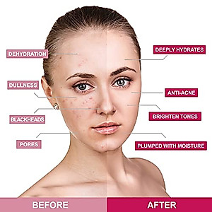 Pink Clay Mud Mask, with Bentonite Kaolin Pink Clay & Rose Extracts, Moisturizing & Anti Aging, Pores Minimizers, Skincare for Women & Men, All Skins, With Face Mask Brush, 500ml 16.9 fl.oz