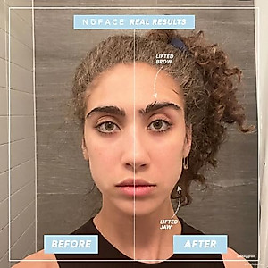 NuFACE MINI Starter Kit ,White