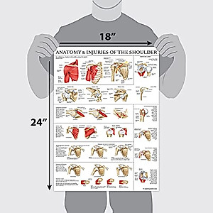 Palace Learning LAMINATED Anatomy and Injuries of the Shoulder Poster - Shoulder Joint Anatomical Chart