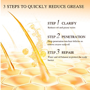 KONO Volume Lift Shampoo for Fine, Flat & Greasy Hair | Classic Series | Clarifying & Cleansing Formula | Anti-Dandruff Treatment | Scalp Care with Niacinamide & Trehalose