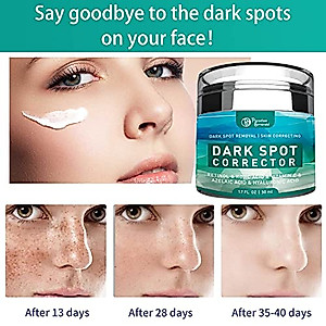 Paradise Emerald Dark Spot Remover for Face, Hyperpigmentation Treatment, Melasma, Freckle, Sun Spots Removal for All Skin Types Dark Spot Corrector for Men and Women