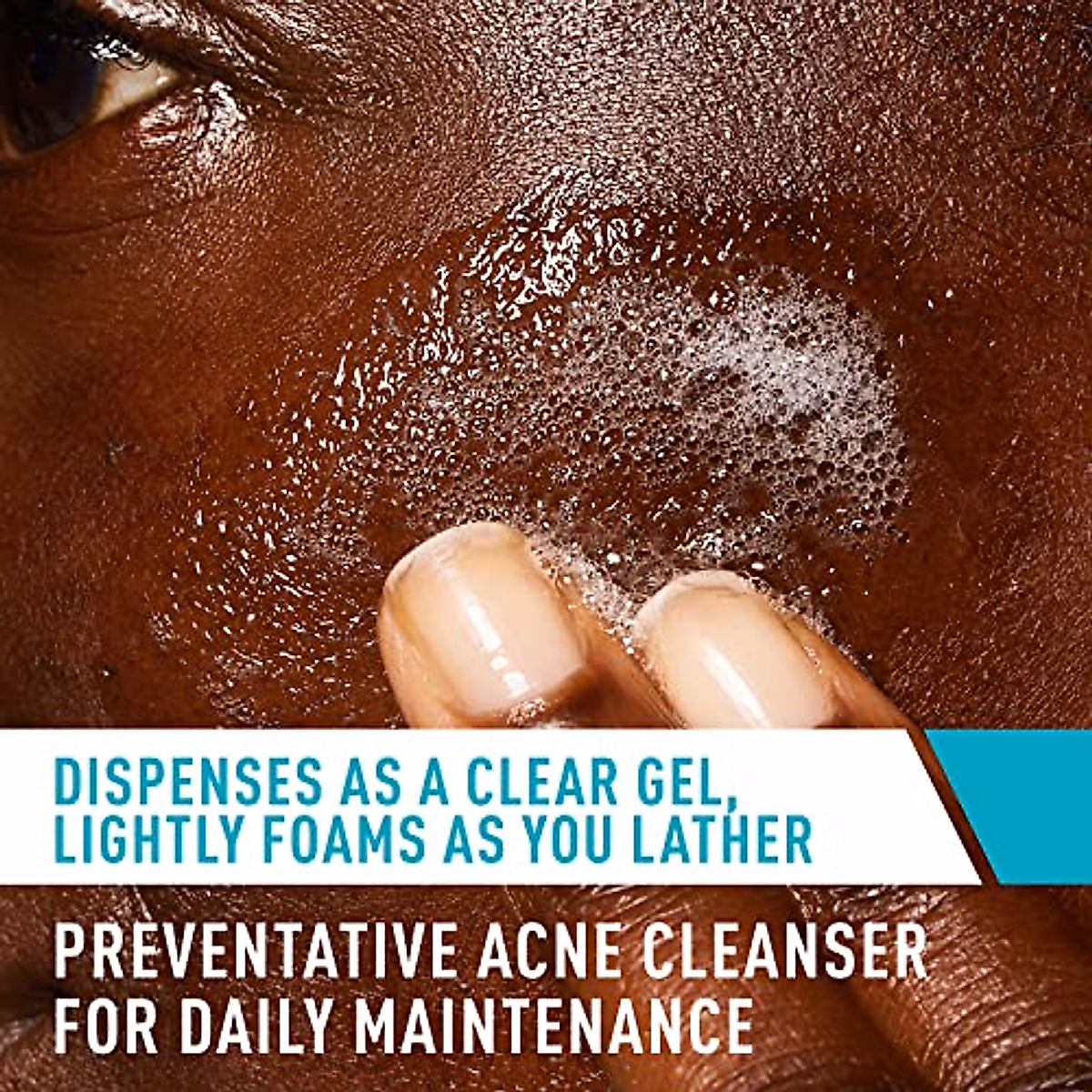 CeraVe Face Wash Acne Treatment | 2% Salicylic Acid Cleanser with Purifying Clay for Oily Skin | Blackhead Remover and Clogged Pore Control | Fragrance Free, Paraben Free & Non Comedogenic| 8 Ounce