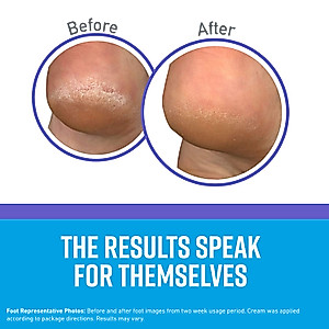 O'Keeffe's Night Treatment Combo Pack Including Working Hands Night Treatment Hand Cream, Healthy Feet Night Treatment Foot Cream and Lip Repair Night Treatment Lip Balm