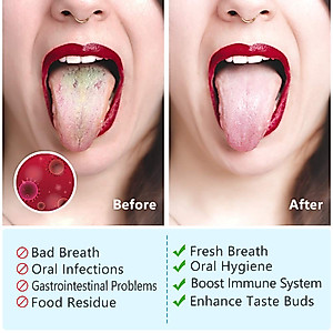 MORGLES Metal Tongue Scraper, 4 Pcs Tongue Cleaners with Case for Adults