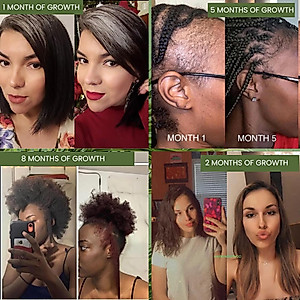 (2-Pack) 10 in 1 Hair Growth Oil (2 Oz) | Formulated With African Chebe Powder For Extreme Hair Growth, 2 Fl Oz (Pack of 1), 2.0 ounces