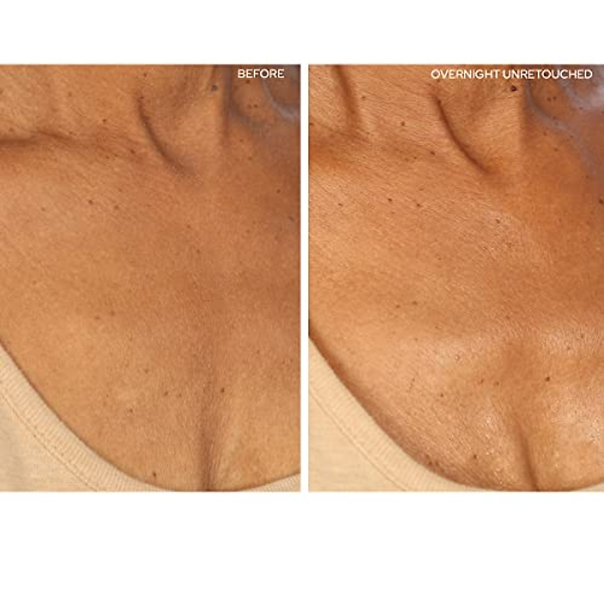 SiO Beauty ChestLift - Chest Anti-Wrinkle Pad 4 Weeks Supply - Overnight Smoothing Silicone Pad For Cleavage & Decollete Skin