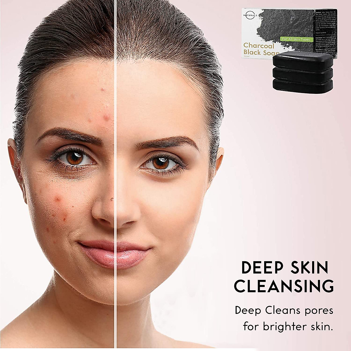 O NATURALS 3 Pack Activated Charcoal Soap Black Bar Soap with Peppermint Oil Detoxifying Body Wash Soap Bar & Face Soap Vegan Men Soap with Shea Butter 100% Natural Soap for Men & Women Soap Bar, 4oz