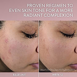 Cetaphil Face Cream, Healthy Radiance Renewing Cream, Visbily Reduces Look of Dark Spots, Brightening Lotion, Designed for Sensitive Skin, Hypoallergenic, Fragrance Free, 1.7oz