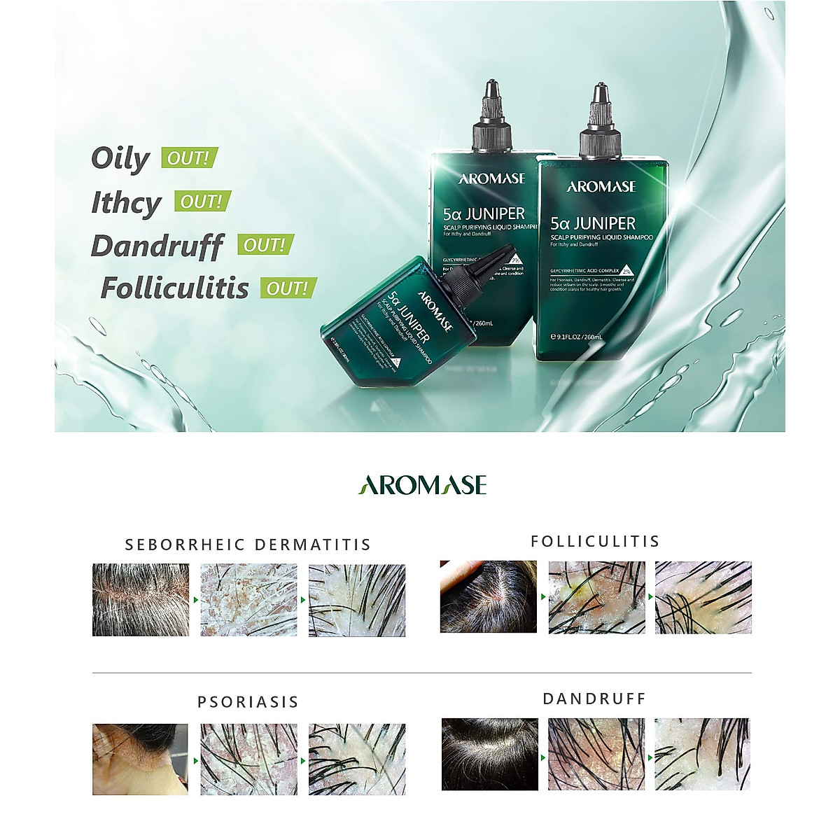 Aromase 5α Intensive Oily Hair Solution Kit (5α Juniper Scalp Purifying Liquid Shampoo 2.8 Fl Oz + 5α Intensive Oily Hair Balancing Essential Shampoo 14 Fl. Oz) for Oily Scalp, Oil Smells