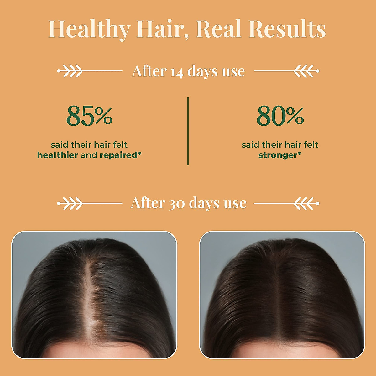 Asna Amla Berry Hair Oil, 100% COLD-PRESSED, Organic, STIMULATES NATURAL GROWTH, Nourishes & Moisturizes Hair/Scalp, AYURVEDIC Blend of VITAMIN C, Antioxidants, Essential Fatty Acids, 30ml (1 oz)