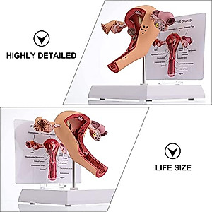 ROLTIN Human Pathological Uterus Model Internal Reproductive System Organ Anatomical Model Human Anatomy Model for Medical Training Aid