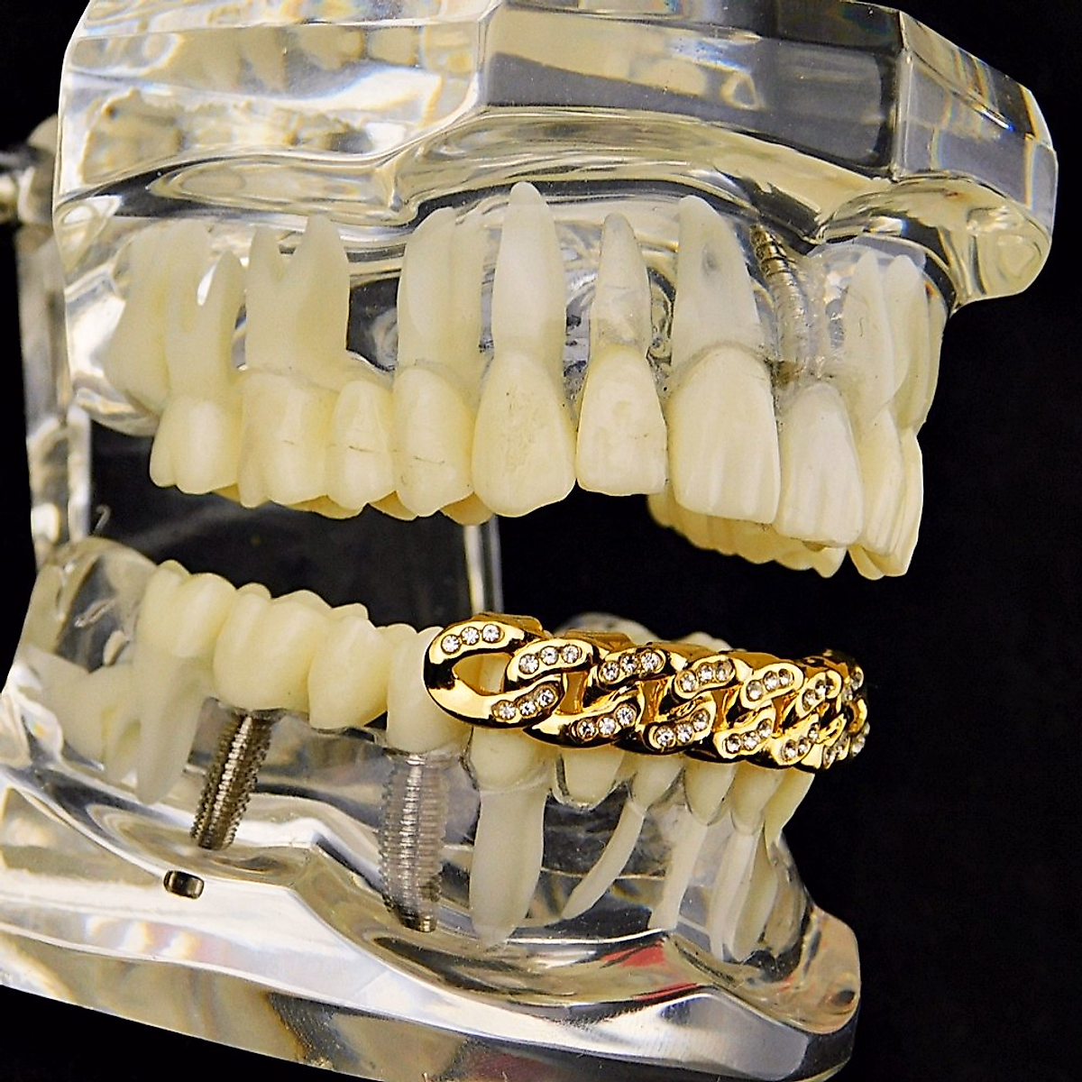 14k Gold Plated Cuban Link Grillz Iced Full Stone Bling Bottom Teeth Hip Hop Grills