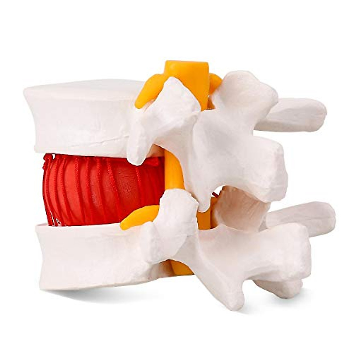 Human Anatomical Lumbar Disc Herniation Model - Lumbar Spine Model for Teaching & Learning - Excellent Way for Demonstrating Disc
