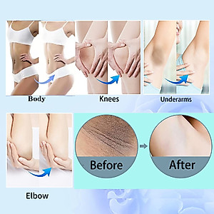 Body Intimate Area Dark Remover For Underarms, Armpit, Knees, Elbows, Inner Thigh, bikini Dark Area Corrector Cream With Natural-Ingredients Designed By USA