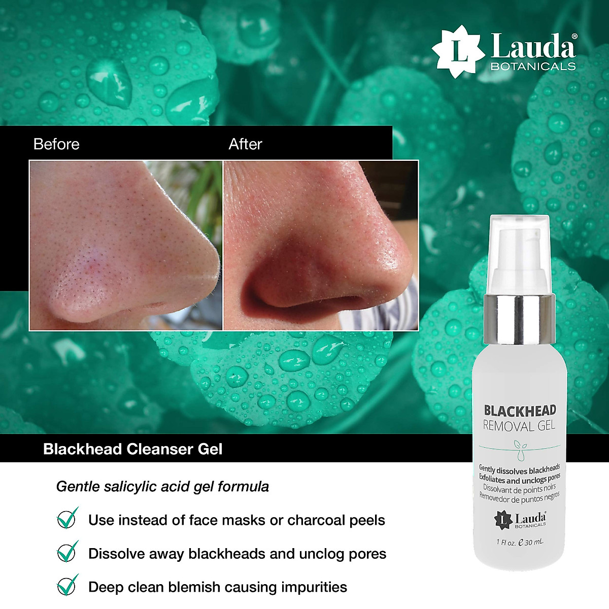 Blackhead Remover Cleanser with Salicylic Acid, Deep Pore Facial Cleanser, Blackhead Eliminator and Dissolving Gel, 1 Ounce by LAUDA BOTANICALS