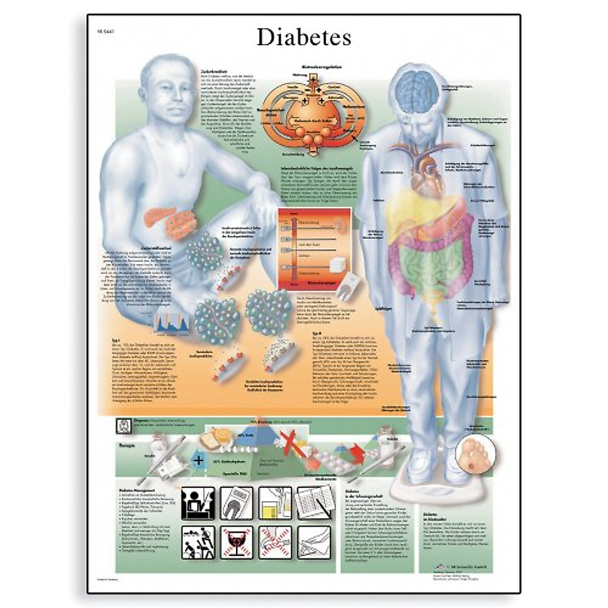 3B Scientific VR1441L Glossy Laminated Paper Diabetes Mellitus Anatomical Chart, Poster Size 20" Width x 26" Height