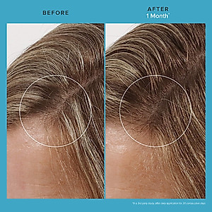 Living proof Scalp Care Revitalizing Hair Treatment for Thicker, Fuller Hair, 2.5 Fl Oz