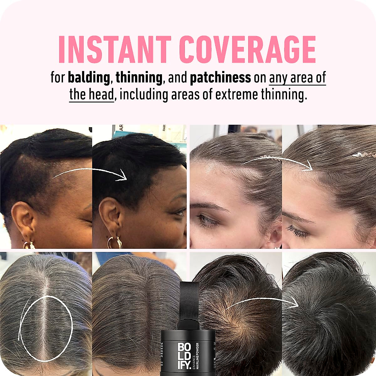 Hair Fiber (Light Brown) + Hairline Powder (Light Brown): Boldify Build & Conceal Bundle - Undetectable Hair Thickener for Fine Hair, Instant Stain-Proof Root Touchup Powder, For Men & Women