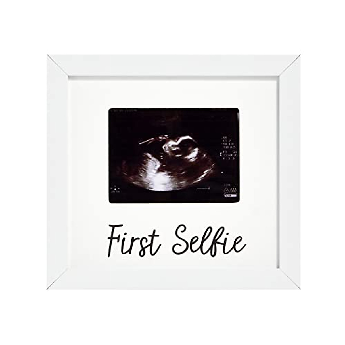 Juvale Baby Sonogram Picture Frame for 4 x 3 Ultrasound Photo, First Selfie (7 x 6.5 In, White)