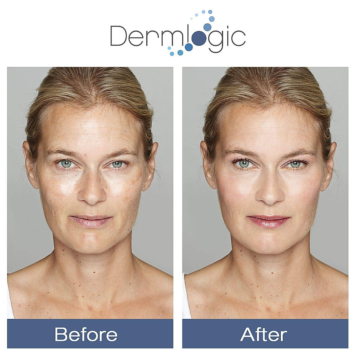 Glycolic Cream 15% - Natural Anti Aging Exfoliator to Smooth Away Fine Lines & Wrinkles & Improve a Dull Looking Complexion. Includes A.H.A & Green Tea Moisturizer for Face & Body.