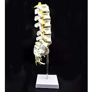 Medical Human Lumbar Spine Demonstration Model Anatomical Model Lumbar Vertebrae Sacrum & Coccyx, with Herniation Disc,for Science Classroom Study Display Teaching Medical Model 15 Inch Hight