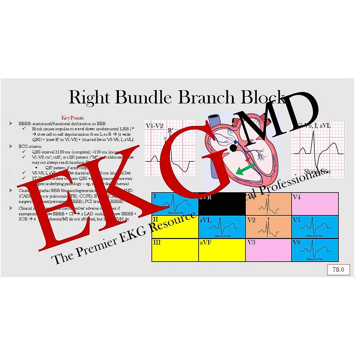 Ultimate EKG Breakdown - The EKG Guy