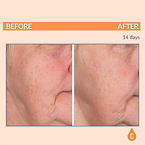 Serious Skincare - C Serum - Vitamin C Ester Skin Conditioner - Anti-Aging - Hydrating - Softer, Radiant Skin - C3 Plasma Hydrolyzed Collagen - For Fine Lines & Wrinkles - 1 oz.