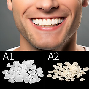 100 Pcs A2 Color Dental Temporary Crown Veneers - Tooth Repair Kit for Missing & Broken Teeth, Orthodontic Care Solution - Temporary Fake Teeth Replacement Set