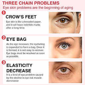 Retinol Eye Stick, Under Eye Cream, With Retinol, Hyaluronic Acid for Dark Circle and Puffiness, Retinol Eye Balm Reduce Wrinkles and Fine Lines, Bags Under Eyes.