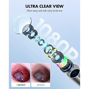 Anykit Ear Wax Removal Tool, Ultra Clear View Ear Scope with LED Lights for Ear Cleaning, Ear Cleaner Camera Otoscope with Ear Spoon & Specula for Phone & Tablet