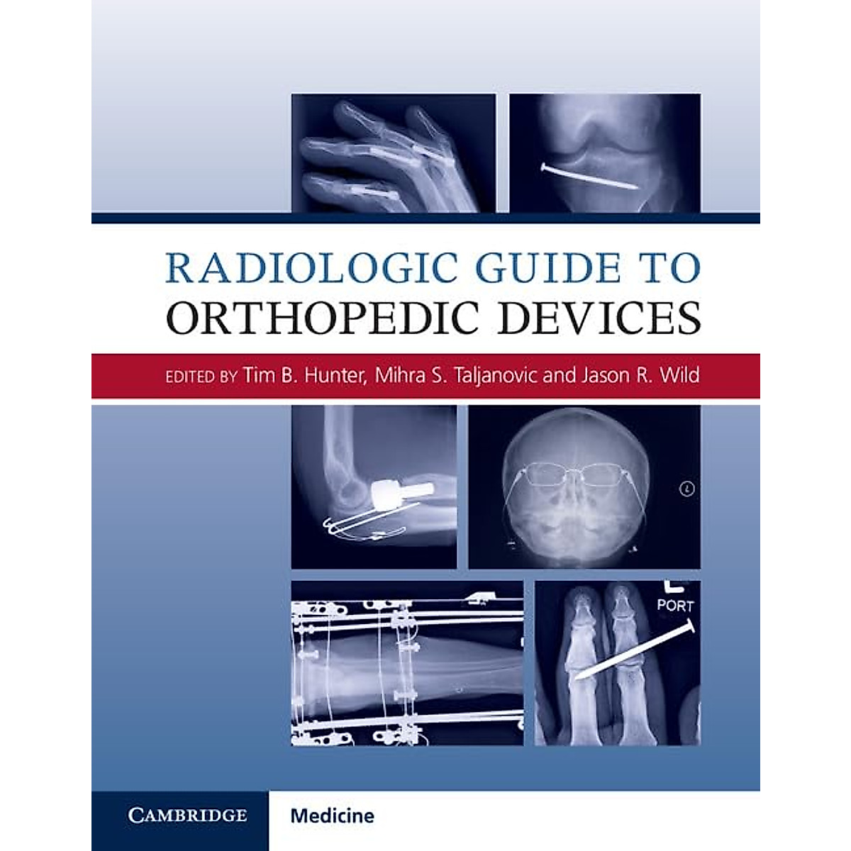 Radiologic Guide to Orthopedic Devices