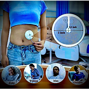 Cutie Button Pads G/j Tube Pad 10 Pack (Boy Mix)