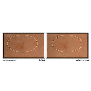 RoC Multi Correxion Revive + Glow 20% Pure Vitamin C Night Serum Capsules for Brightening, Dark Spots, and Texture