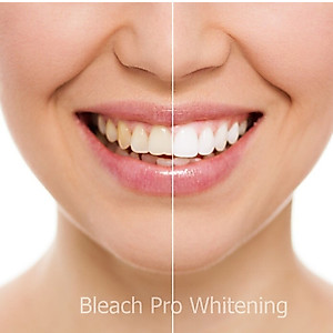 Teeth Whitening Gel 16% Carbamide Peroxide 3ml Dispensers 10 pcs