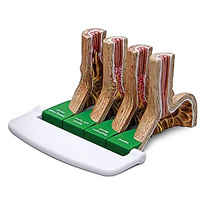GPI Anatomicals - 4-Piece Stomach Model Set with Gastroesophageal Reflux Disease (GERD), Replica for Human Anatomy and Physiology Education, Anatomy Model for Doctor's Offices, Medical Study Supplies