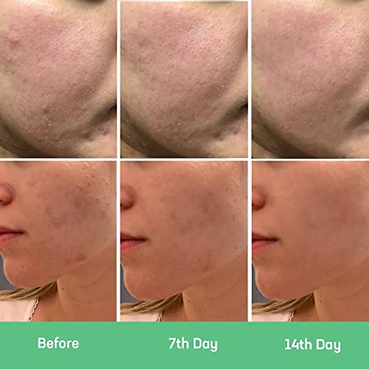 Azani 10% Lactic Acid + Squalane Resurfacing - 1.01 Oz Serum | Face Exfoliating AHA to Soften and Smooth Skin, Brighten Complexion and Diminish Fine Lines & Wrinkles - Women & Men