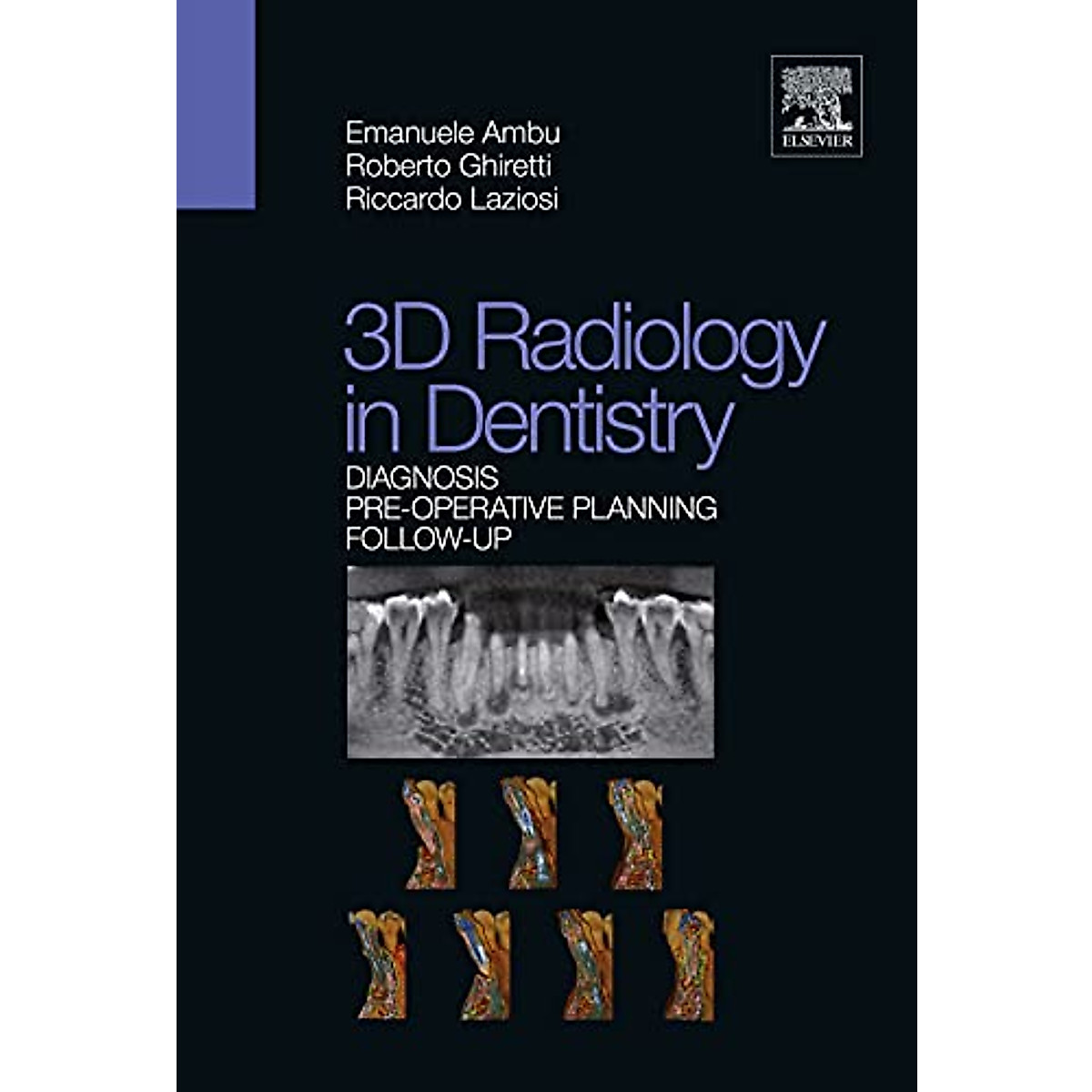 3D radiology in dentistry - Diagnosis Pre-operative Planning Follow-up