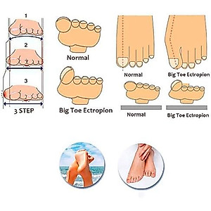 baolaili 1 Pair White Bunion Cushion and Protector Silicone Big Toe and Relieve Bunion Pain Bunion Pads Gel Bunion Corrector Guards Pad Cushion Toe Protector Straightener Toe Separators Realign