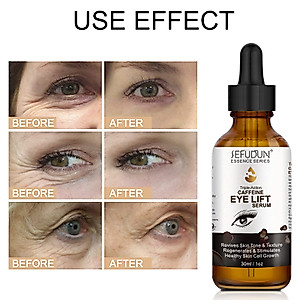 Caffeine Eye Serum, Eye Serum Anti Aging Wrinkles Effectively Fades Dark Circles, Eye Bags, Helping to Minimize Wrinkles and Fine Lines, Eliminate Puffiness, with EGCG, Vitamin C Under Eye Serum 30ml