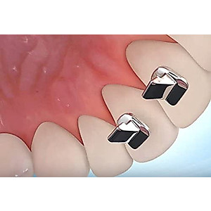 10 Pcs SmileTech New Bite Turbos Dental Orthodontic Materials