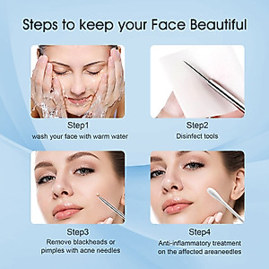 Blackhead Removal Tools, 4 Pcs Pimple Popper Tool Kit, Professional Stainless Pimples Comedone Extractor with Portable Case(Silver)