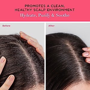 Unwash Balancing Scalp Serum - Nourish & Soothe Dry, Flaky Itchy Scalp, Nourishing Scalp Treatment, Balances Moisture, Micriobiome Friendly, Sulfate Free, 2.5 fl oz