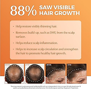 BosleyMD BosRevive Nourishing Shampoo for Noticeably Thinning Hair (Color Safe), 10.1 fl oz.