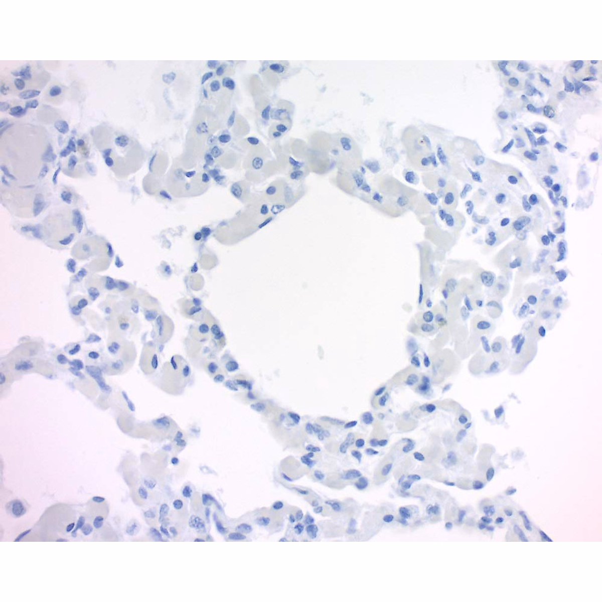 Hematoxylin, Weigert's Iron Stain Pack, 500ml